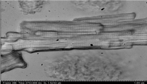 How to export video from HVSL/VSL