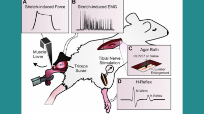 Muscle Physiology Archives - Aurora Scientific