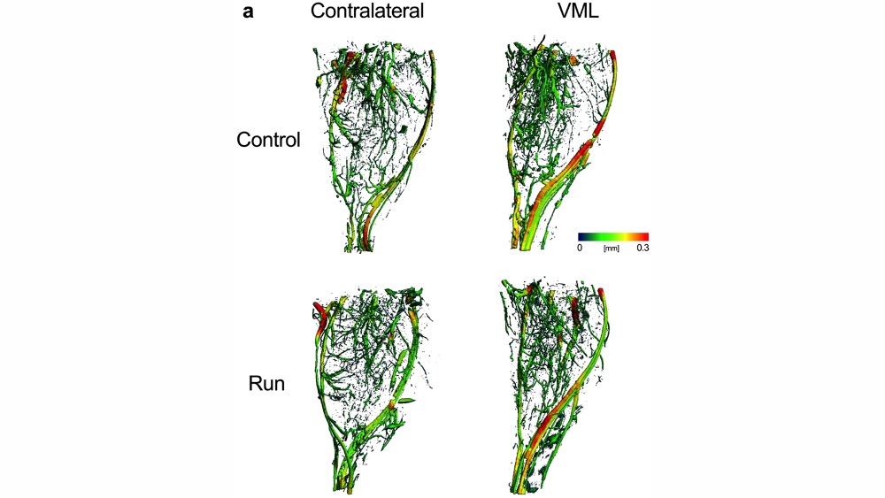 Assessing Muscle Function Following Severe Muscle Atrophy | Aurora ...